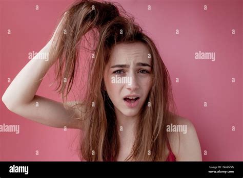 Problem Scalp Greasy Dirty Hair Girl Haircare Concept Stock Photo Alamy