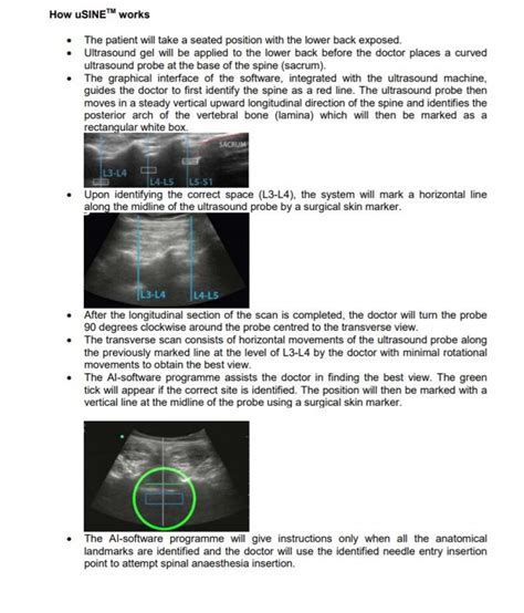 Worlds First Ai Powered Ultrasound Guided Automated Spinal Landmark