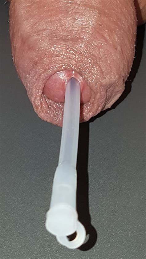 Catheter Insertion 111 Pics XHamster