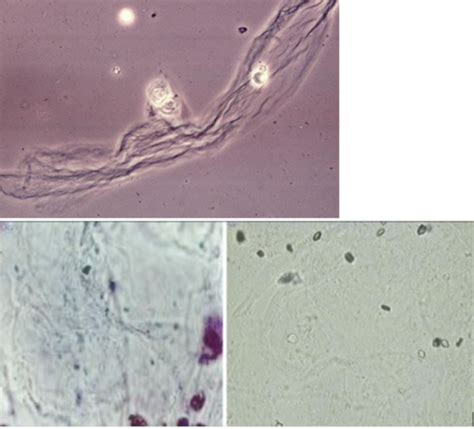 Bacteria Fungi Yeast Sex Cells Etc Microscopic Ua Flashcards Quizlet Bacteria Fungi Yeast Sex Cells Etc Microscopic Ua Flashcards Quizlet