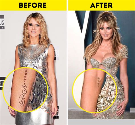 Tattoo Regrets 15 Celebrities Who Decided To Erase Their Ink