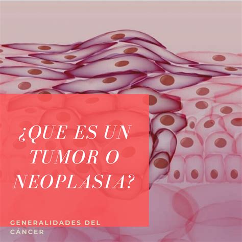 ¿Qué es un TUMOR o NEOPLASIA?