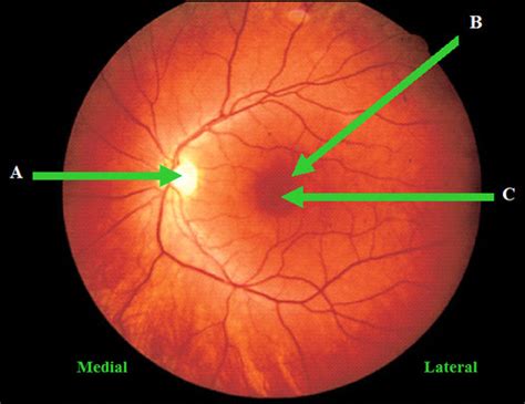 Gross Anatomy Of The Eye 914 Flashcards Quizlet