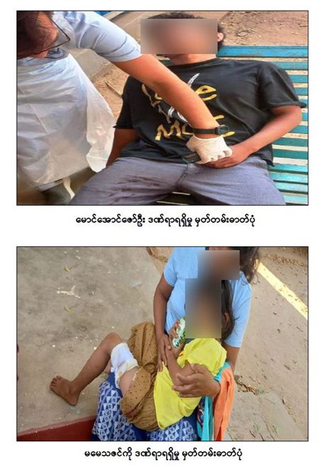 အရာတော်မြို့နယ်၌ ကျောင်းသား၊ ကျောင်းသူများ စီးနင်းလိုက်ပါလာသော မော်တော် ယာဉ်အား Pdf အမည်ခံ အကြမ