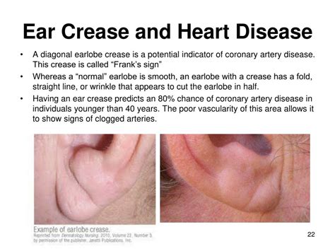 Ppt Senses And Ear Powerpoint Presentation Free Download Id 1065910