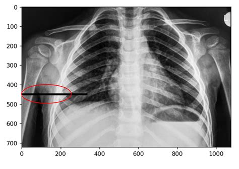 Cropping Images In Python OpenCV So Image Doesn T Include Dead White