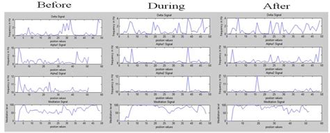 Figure 3 From Design And Implementation Of Eeg Signals Analysis On Fpga Semantic Scholar
