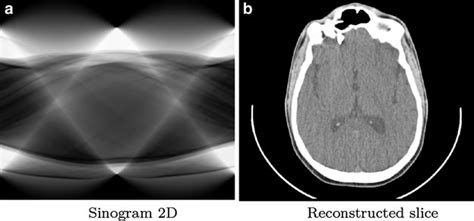 Example of sinogram 2D and reconstructed image | Download Scientific Diagram