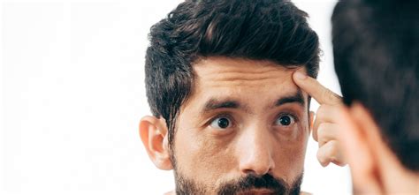 Forehead Lines Treatment Captivate Iv Wellness And Beauty Bar