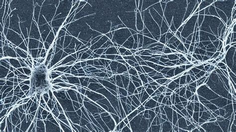 Microscopic View Of A Neuron Taken With Scanning Stable Diffusion