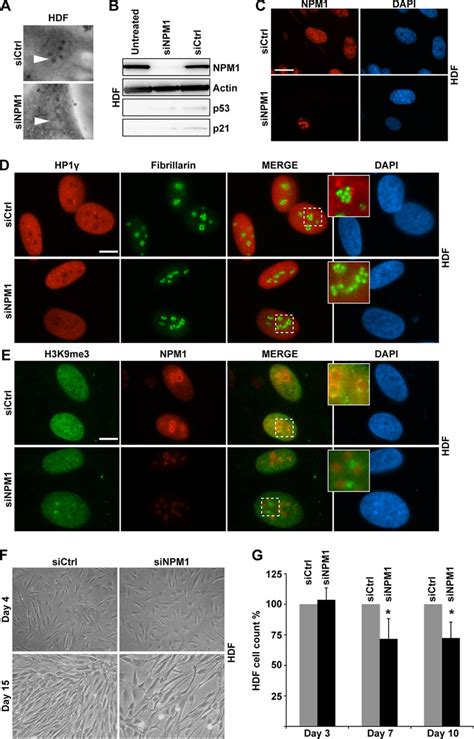 Npm1 Depletion Alters The Structure Of Nucleoli In Normal Human Diploid Download Scientific