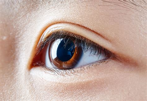 갑자기 눈이 빨갛게 충혈됐다면 눈 충혈 원인과 의심 질환 4가지 정리 닥터나우