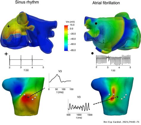 Cardiac Computational Modelling Revista Española De Cardiología