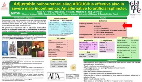 Poster Aua Ppt
