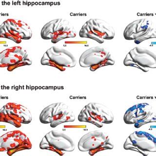 Within Group RSFC Patterns And Between Group RSFC Differences In The Download Scientific