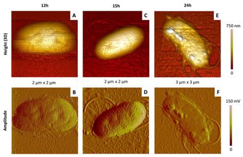 Ijms Free Full Text Impact Of Growth Conditions On Pseudomonas Fluorescens Morphology