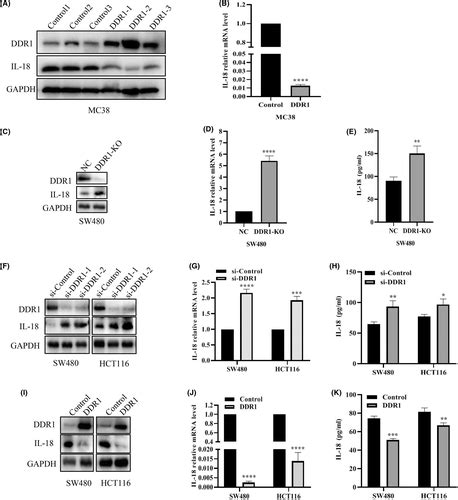 DDR Functions As An Immune Negative Factor In Colorectal Cancer By Regulating Tumor