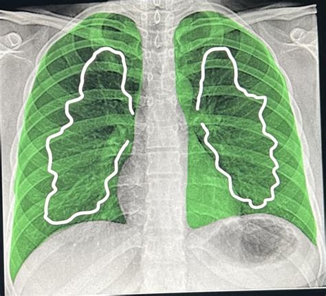 Week 3 Slides Flashcards Quizlet