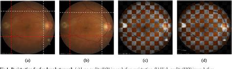 Figure 1 From A Deep Learning Based Framework For Retinal Fundus Image Enhancement Semantic