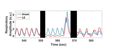 6 Three Projections Of A Respiratory Surrogate Derived From A Lung Download Scientific Diagram