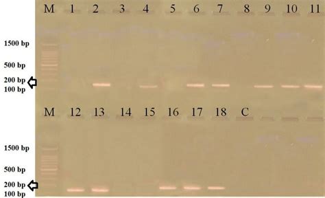 2 Polymerase Chain Reaction Amplification Products Using Specific Download Scientific Diagram