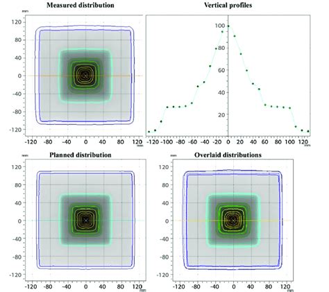 Comparison Of The Planar Doses Between The Tps Calculated And