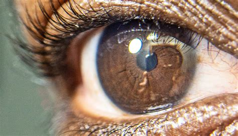 Discovery Could Lead To Earlier Glaucoma Detection And Treatment Futurity