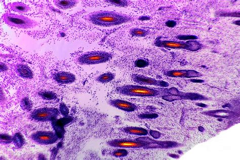 Scalp Tissue Photograph By Dr Keith Wheeler Science Photo Library Pixels