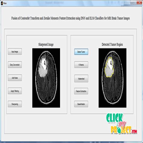 Fusion Of Contourlet Transform And Zernike Moments Feature Extraction