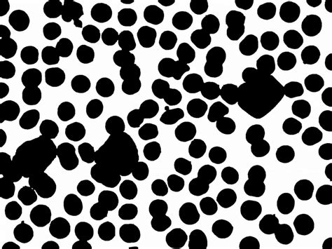 Watershed Segmentation Implementation Using Scikit Image Researchgate