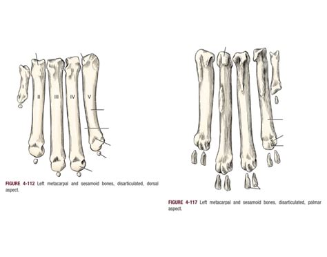 Left Metacarpal Dorsal Aspect Quiz