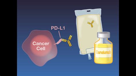 Perioperative Chemoimmunotherapy In Lung Cancer Nejm Youtube