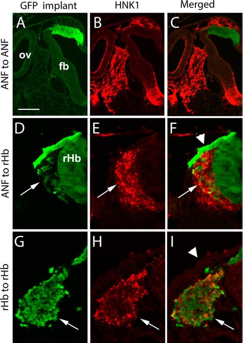 Stage Dependent Plasticity Of The Anterior Neural Folds To Form Olfactory Placode Versus Neural
