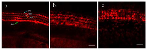 Hair Cell Death Induced By Cocl 2 Exposure Cochlear Explant Cultures