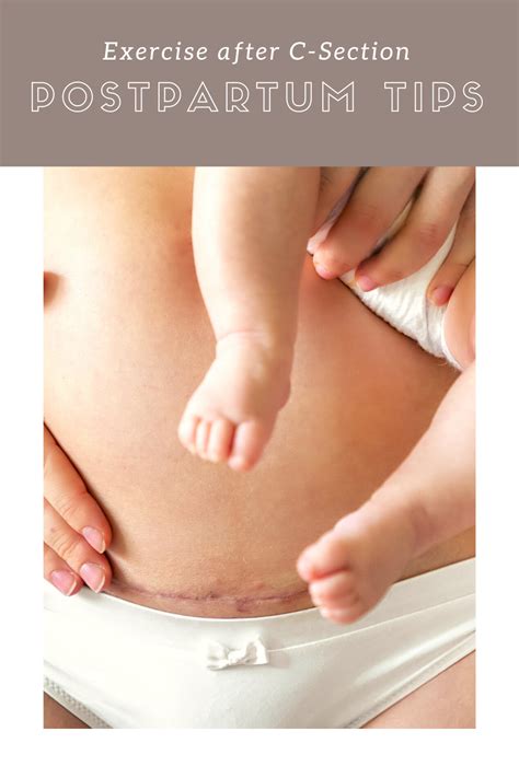 When To Start Exercise After C Section A Guide For New Moms Artofit