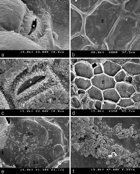 Scanning Electron Micrographs Of The Epidermis Obtained From Plants