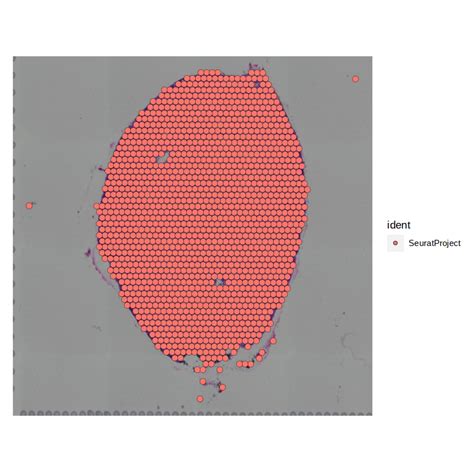 spatial charting of single cell transcriptomes in tissues celltrek