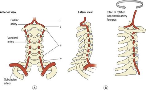 Cervical Vertebral Artery Test