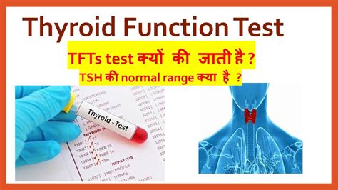 Thyroid Function Test What Is Tft Tsh Thyroxin Youtube