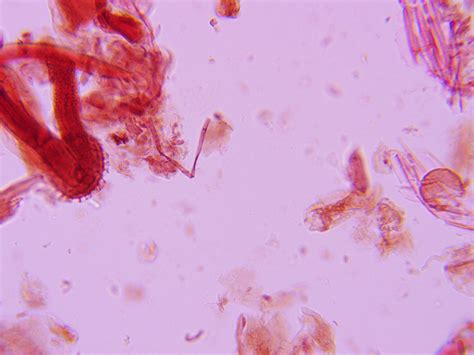 Uk 4 Augmented Object Detection Dataset By Gill Hunt