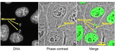 Figure 1 From The Consequences Of Chromosome Segregation Errors In