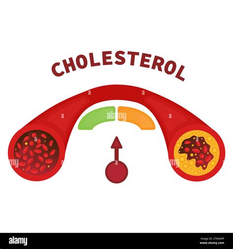Cholesterol Levels Conceptual Illustration Stock Photo Alamy