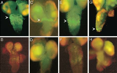 Expression Of Ant Scr Ubx And Abd B Proteins In Wild Type And