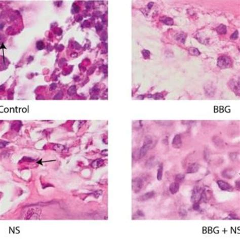 Elian Classification Of Sockets Chaar Et Al Classification 3