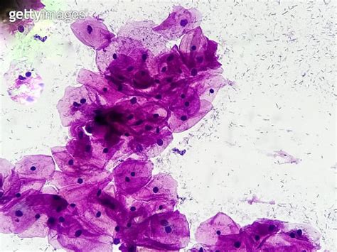 Squamous Epithelial Cells Micrograph 이미지 1345769194 게티이미지뱅크