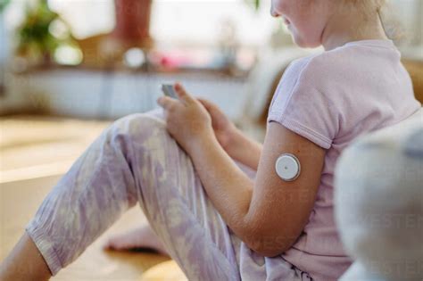 Diabetic Girl With Continuous Glucose Monitor On Arm The Cgm Device