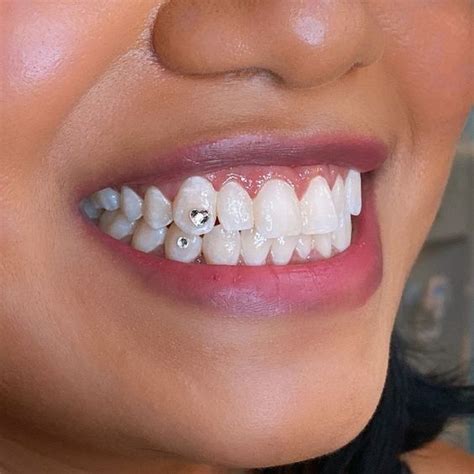 Piercing No Dente O Retorno De Uma Tendência Bijou Dentaire Hygiène