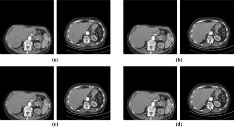 Attacked Images Under Jpeg Compression Attacks A Jpeg 10