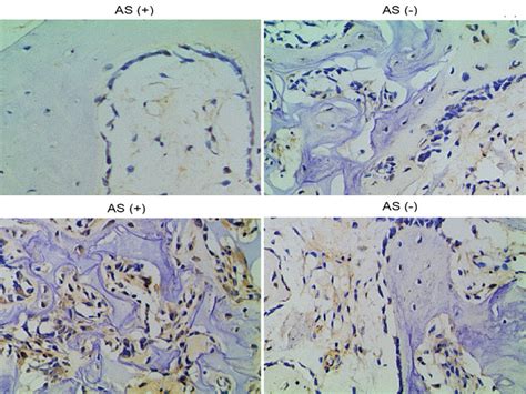 Astragaloside Accelerates Fracture Healing Via Modulating Mir 122 P53