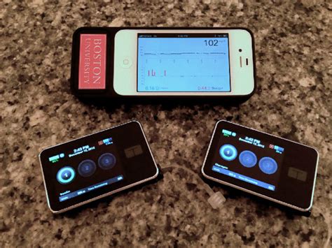 what the iphone based artificial pancreas means to patients and
